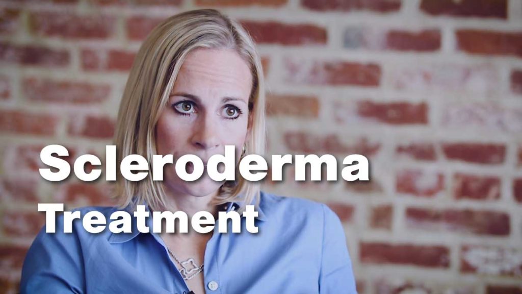 Signs and Symptoms of Scleroderma - Johns Hopkins RheumTV