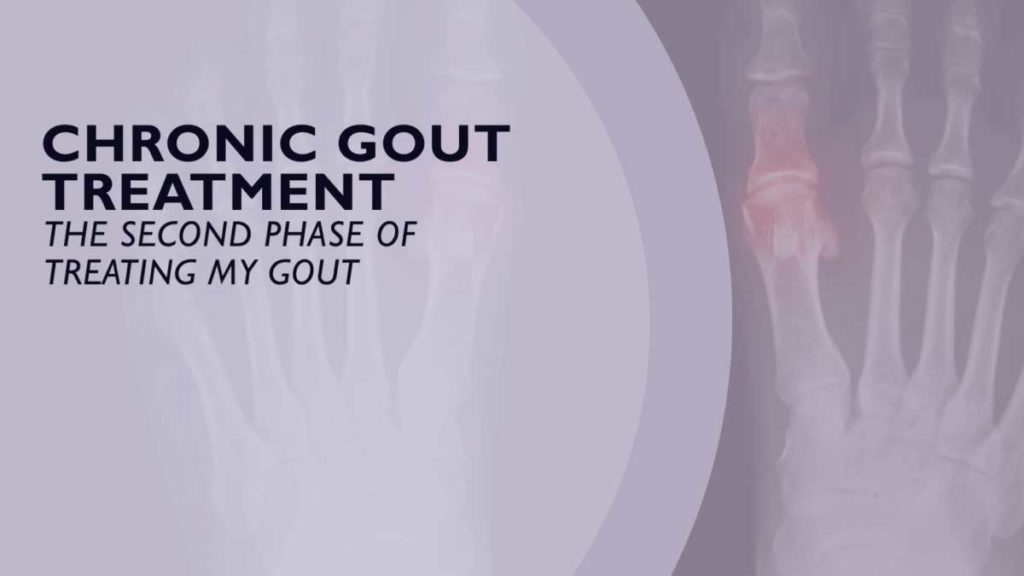 Gout: Basics, Symptoms and Treatment Options - Johns Hopkins RheumTV